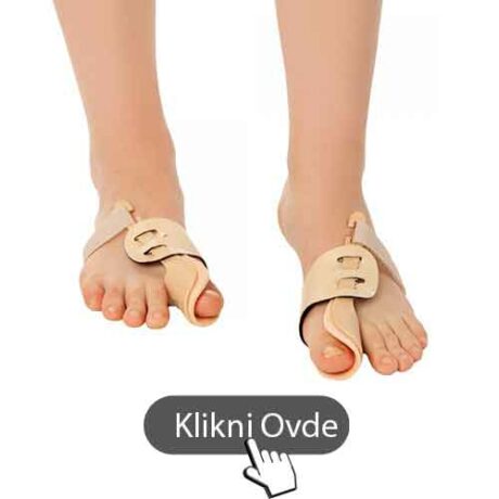 Kako Prirodno Lečiti Čukljeve na Nogama: Saveti i Metode